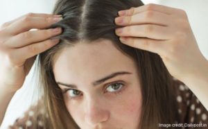 13 Best Ways to Get Rid of The White Hair in Teenagers